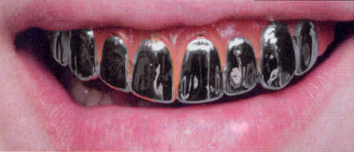 Platinum Veneer Teeth Pro | horror-shop.com